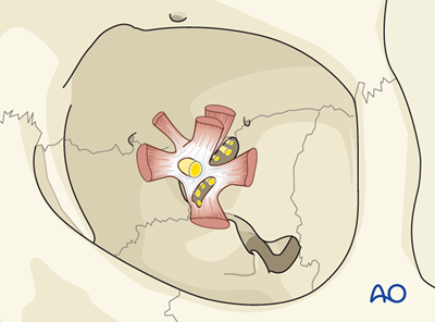 Periorbital dissection - Introduction