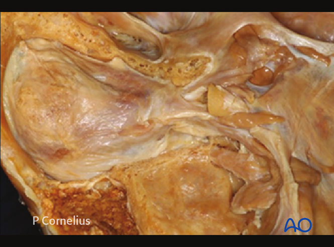 Periorbital dissection - Introduction