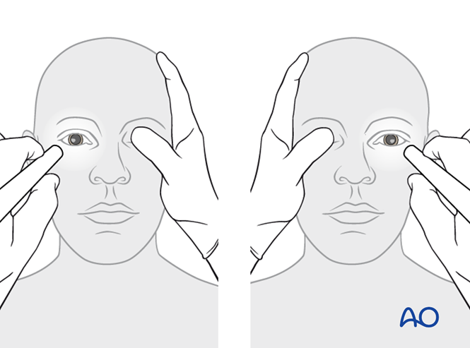Examination of patients with midfacial post traumatic deformities