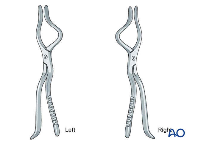 Open reduction internal fixation for Le Fort III fracture