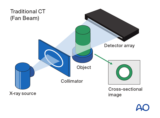 Intraoperative navigation: cone beam vs fan beam