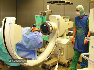 CAS: intraoperative imaging in closed treatment