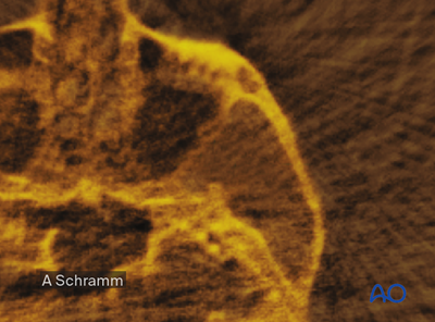 CAS: intraoperative imaging in closed treatment