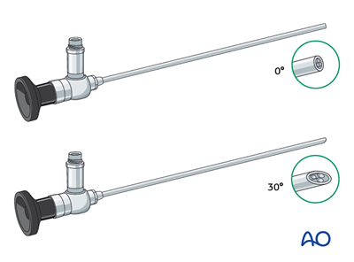 Endoscopic repair of CSF leak for Skull base fracture, central (anterior)