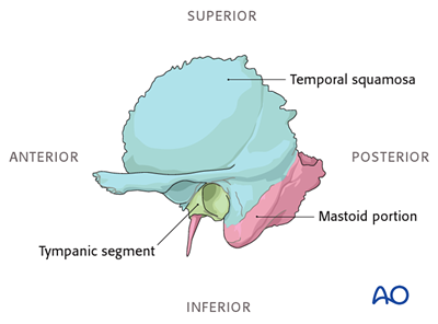 Skull base fracture, temporal bone