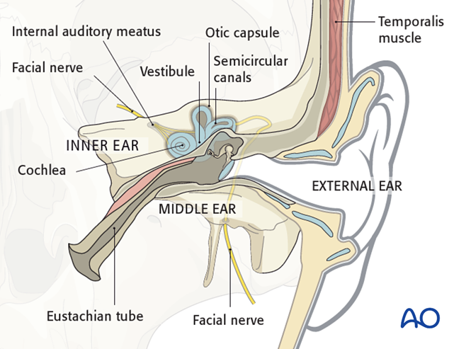 Skull base fracture, temporal bone