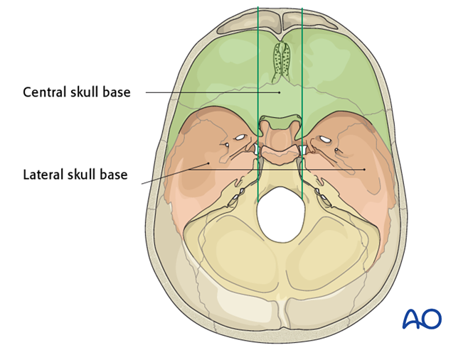 Skull base fracture, anterior