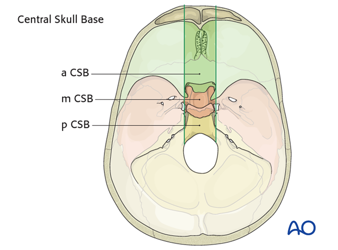 Skull base fracture, anterior