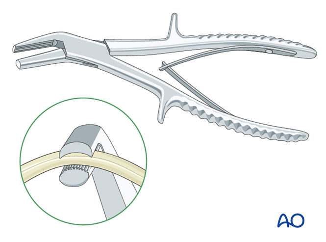 Construction of Zygomatic arch and Glenoid fossa for Pruzansky III