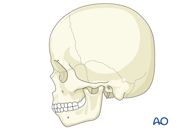 Posterior vault expansion by distraction osteogenesis for Syndromic ...