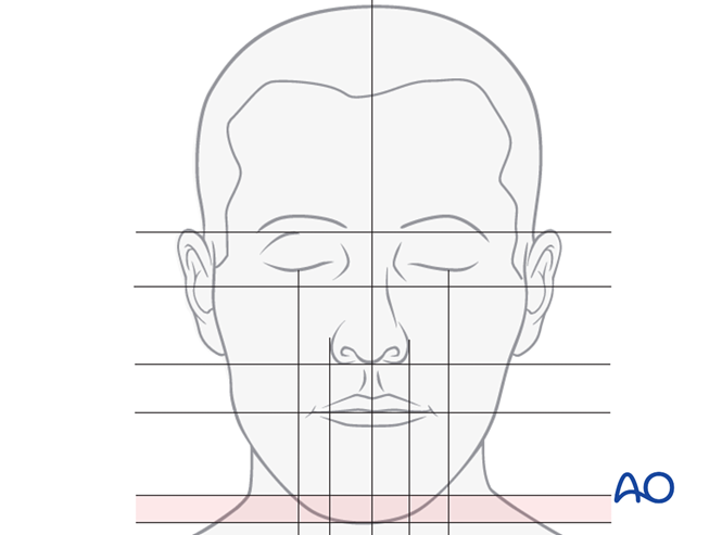 Planning of orthognathic surgery