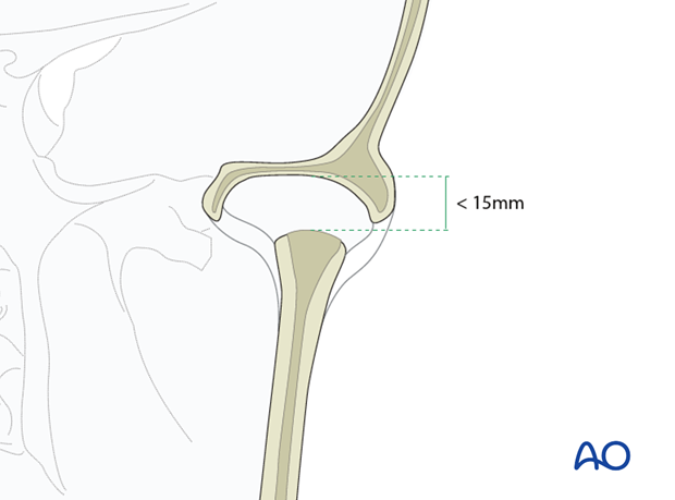 Condylar arthroplasty for Mandibular malunion - TMJ Dysfunction