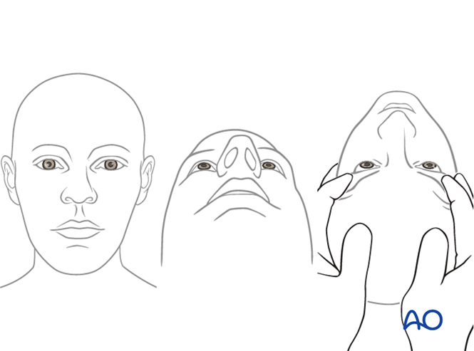 Examination of patients with midfacial post traumatic deformities
