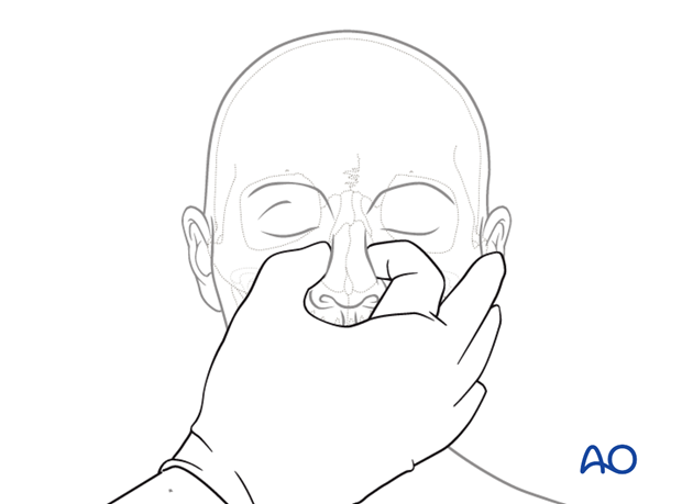 Examination of patients with midfacial post traumatic deformities