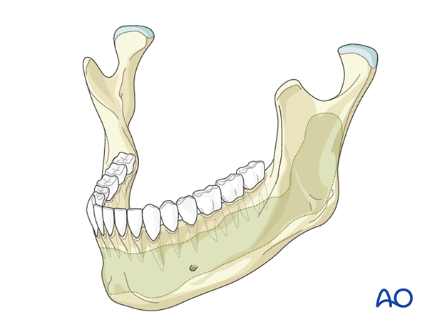 Symphysis, lateral, condyle, mucosa, with or without tongue (smaller ...