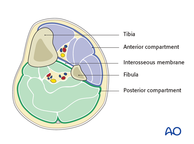 Fibula osteocutaneous flap harvest