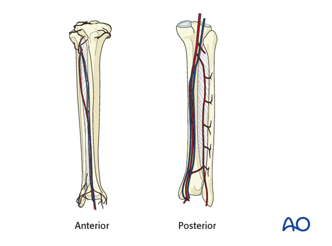 Fibula osteocutaneous flap harvest