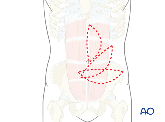 Rectus abdominis