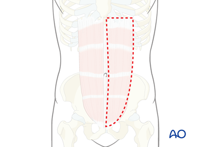 Rectus abdominis