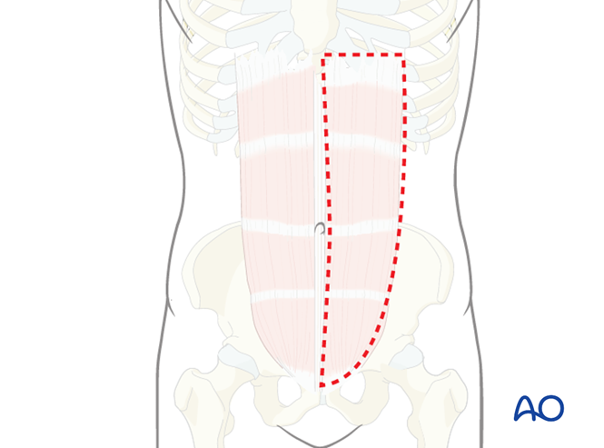 Rectus abdominis