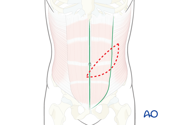 Rectus abdominis
