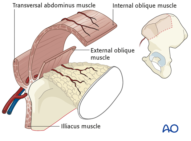 Plate and iliac crest internal oblique free flap for Symphysis, mucosa ...