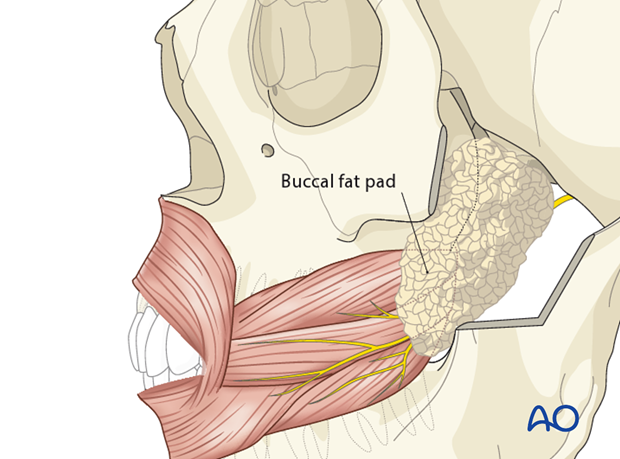 Buccal fat pad for Brown I, alveolus