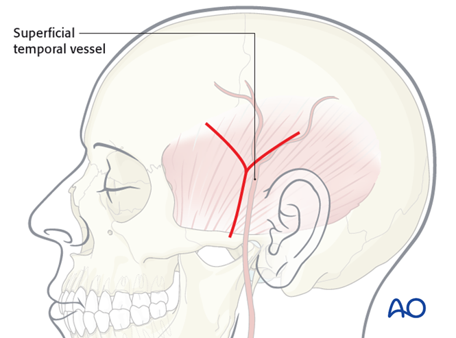 Temporalis muscle flap for Brown I, alveolus