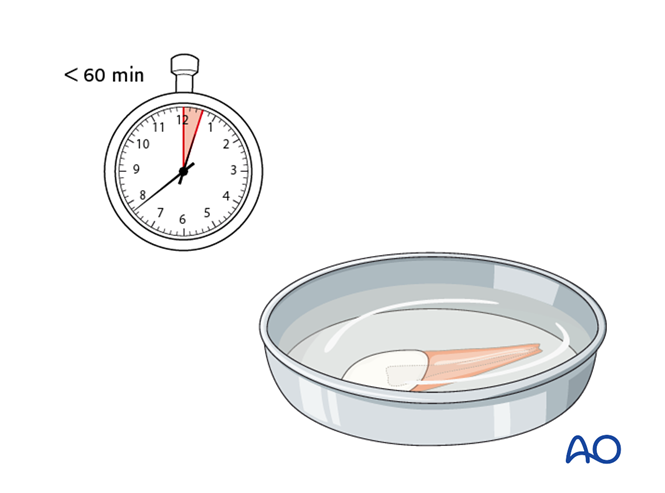 Various treatment options for Tooth luxation, avulsion (total luxation)