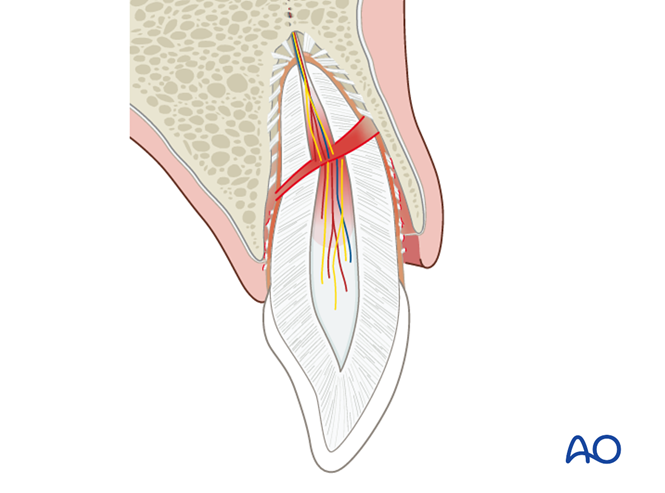 Tooth fracture, root fracture