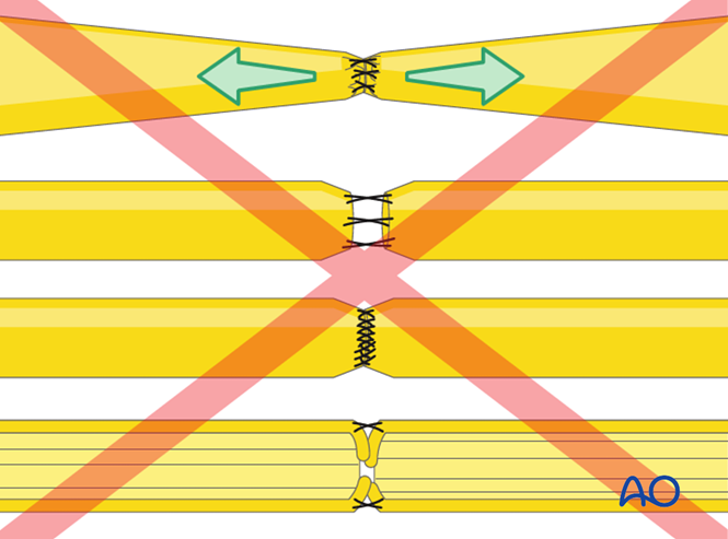 Nerve repair technique