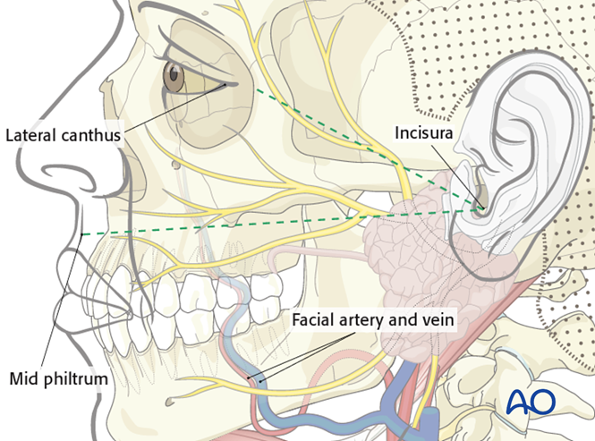 Interpositional nerve graft for Reversible paralysis