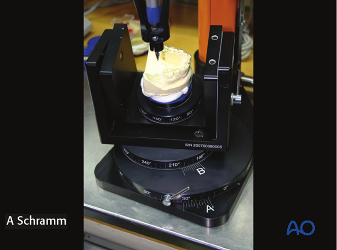 Computer assisted dental implant surgery