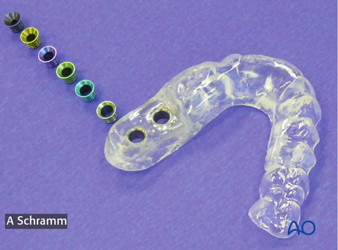 Computer assisted dental implant surgery