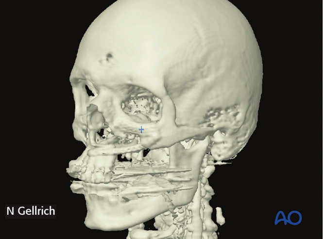 Biopsy mapping