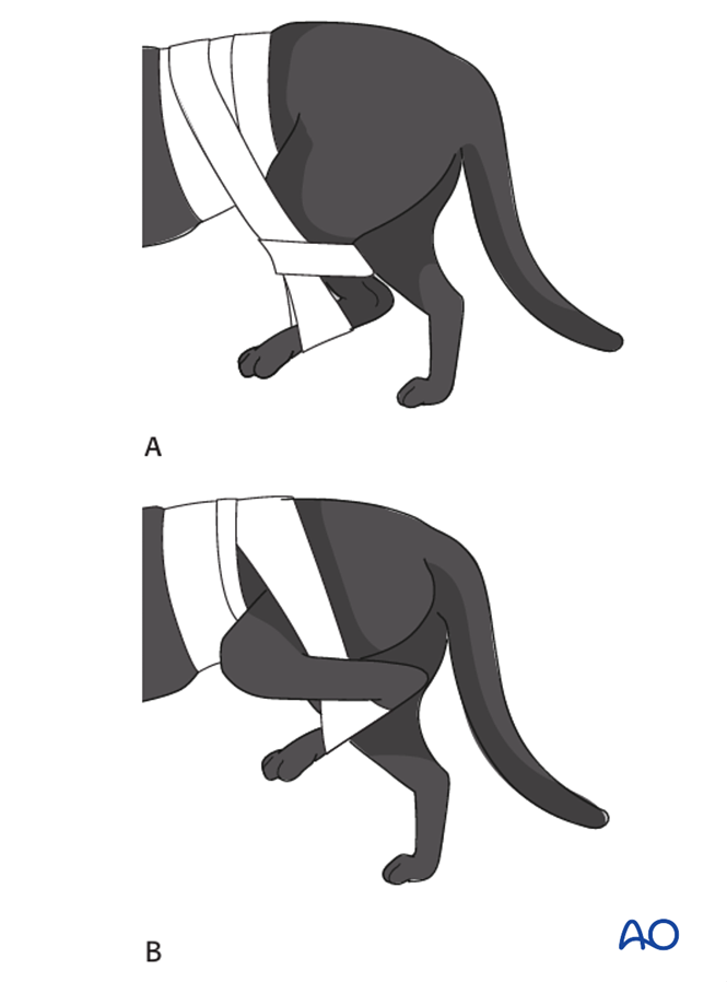 Femoral head and neck ostectomy for Capital, articular simple