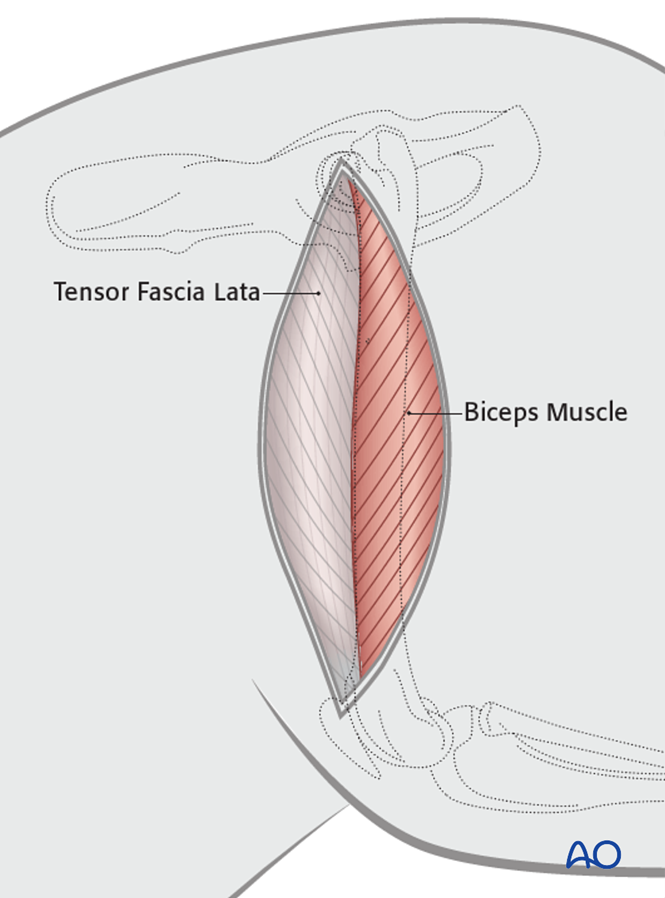 Open approach to the cat femoral shaft