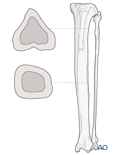 Open craniomedial approach (and OBDNT) to the cat tibial shaft