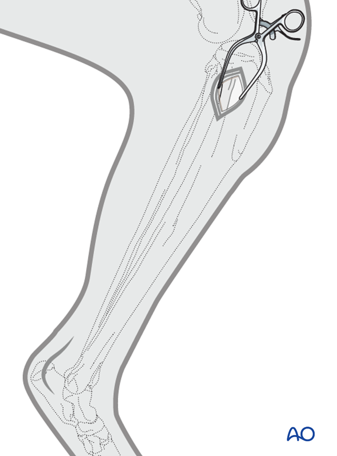 Approaches for minimally invasive osteosynthesis (MIO) to the cat ...