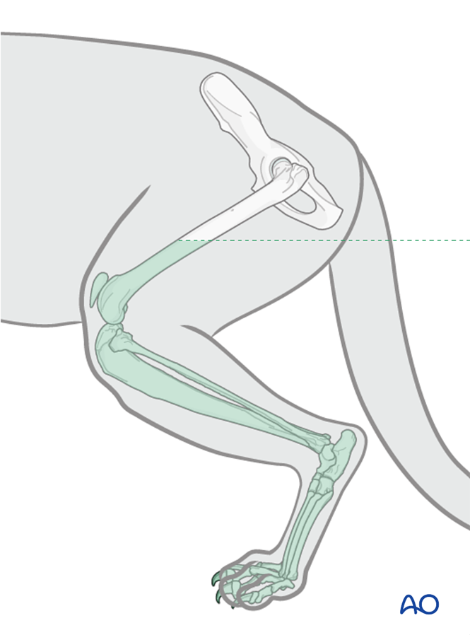 Nonsurgical fracture management for Incomplete fracture of the tibia or ...