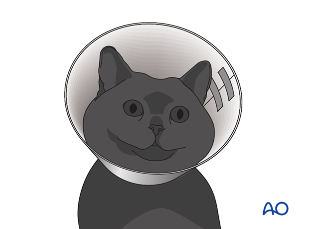 Circummandibular wiring and dental composite for Mandible ...