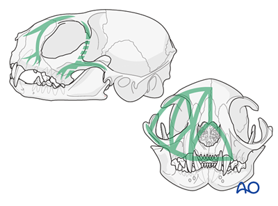 General considerations with midface fractures