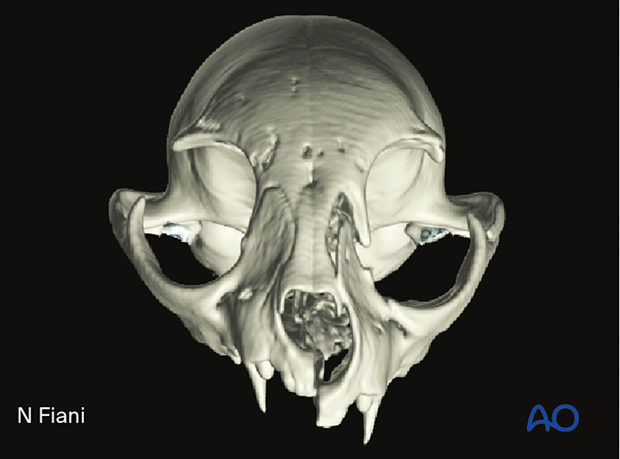 Management of fractures in the pediatric patient