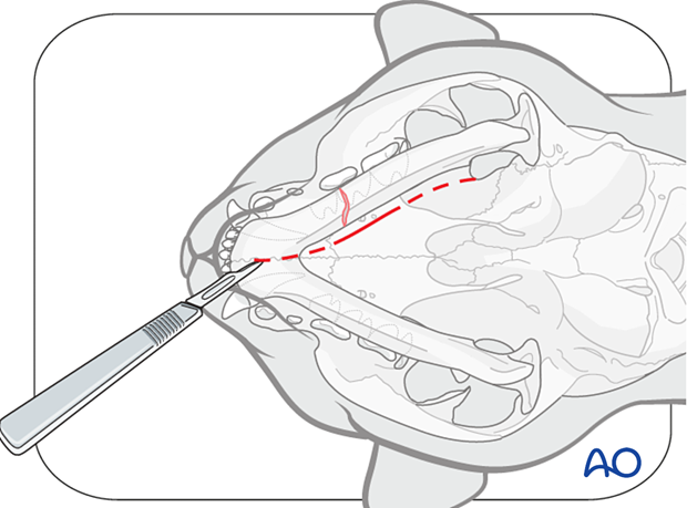 Ventral approach to mandibular body