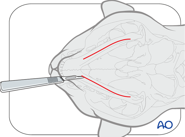 Ventral approach to mandibular body