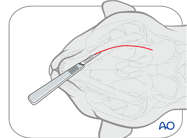 Ventral approach to mandibular body