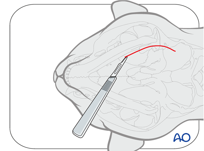 Ventral approach to the caudal mandible