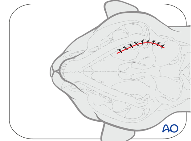 Ventral approach to the caudal mandible