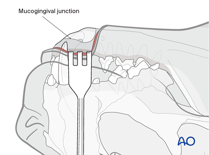 Ventral approach to the cat rostral mandible