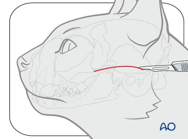 Lateral approach to the temporomandibular joint